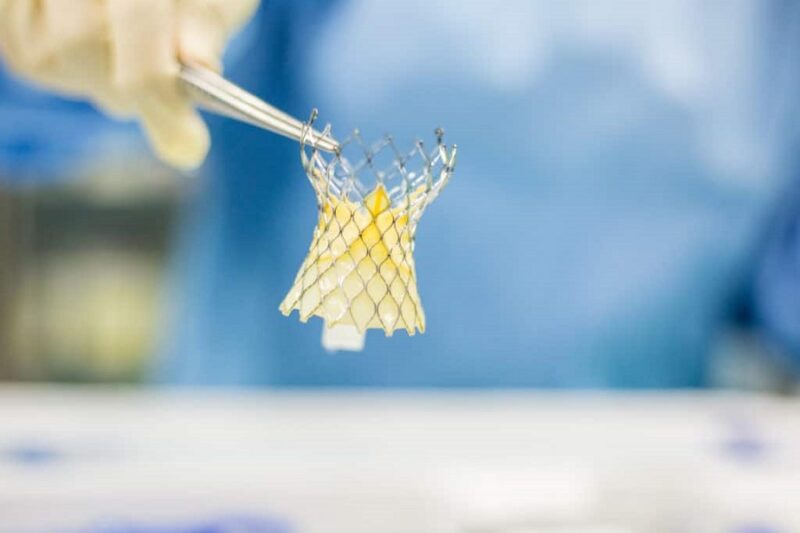 Impacto pronóstico de los gradientes de presión transvalvular post-TAVI ...